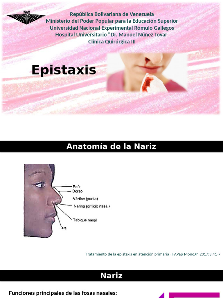 Orl Epistaxis | PDF | Nariz humana | Especialidades Medicas