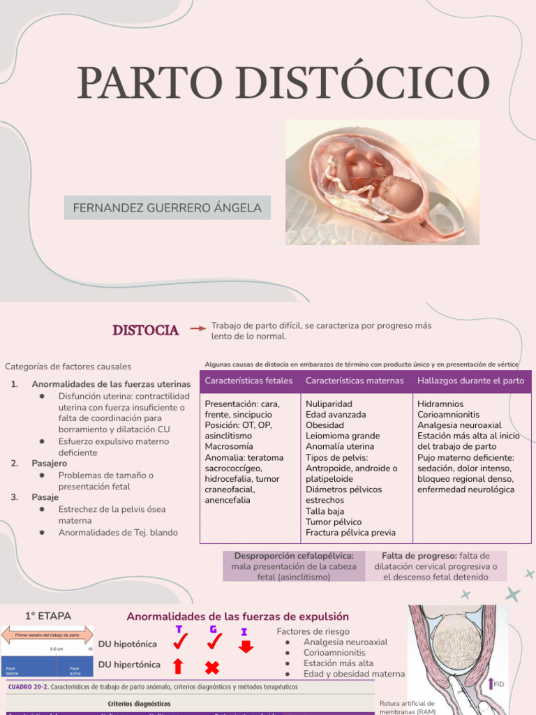 Parto Distócico | PDF | Parto | Obstetricia
