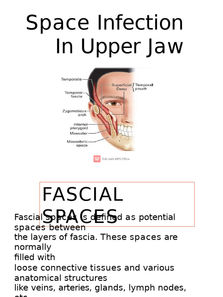 Space Infection in Upper Jaw (1) - 1 | PDF | Human Head And Neck ...
