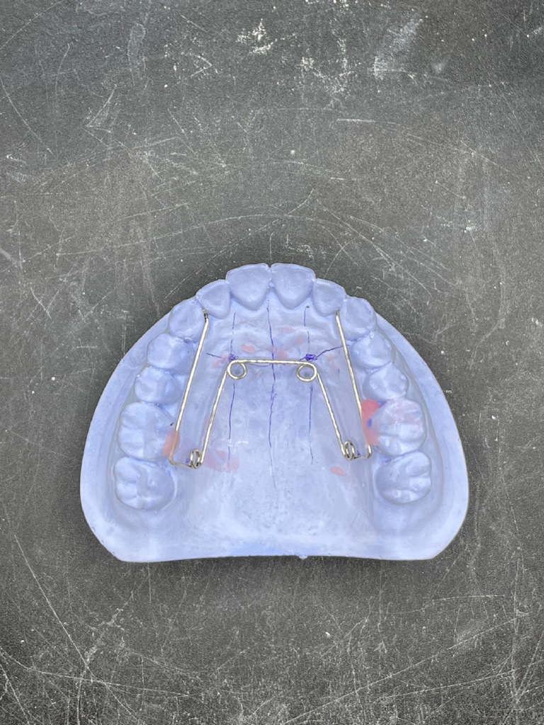 Quad Helix | PDF