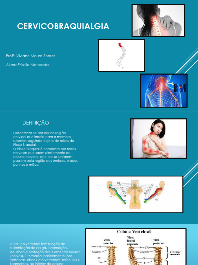 Cervicobraquialgia PDF | PDF | Vértebra | Sistema Locomotor