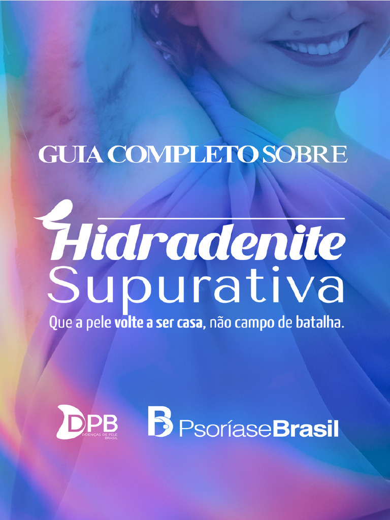Tratamento da Hidradenite Supurativa | PDF | Dermatologia | Dor