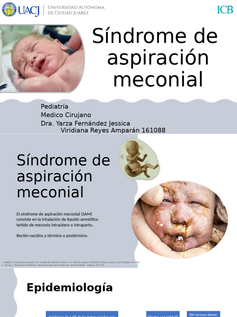 Síndrome de Aspiración Meconial en Recién Nacidos | PDF ...