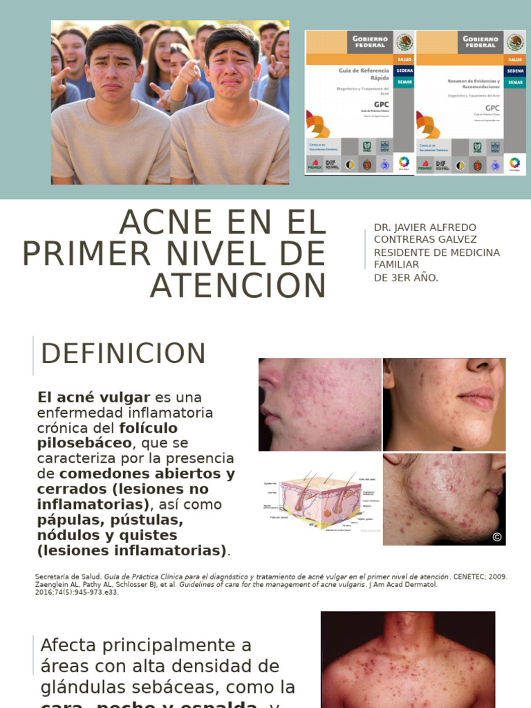 Acne | PDF | Inflamación | Enfermedades y trastornos
