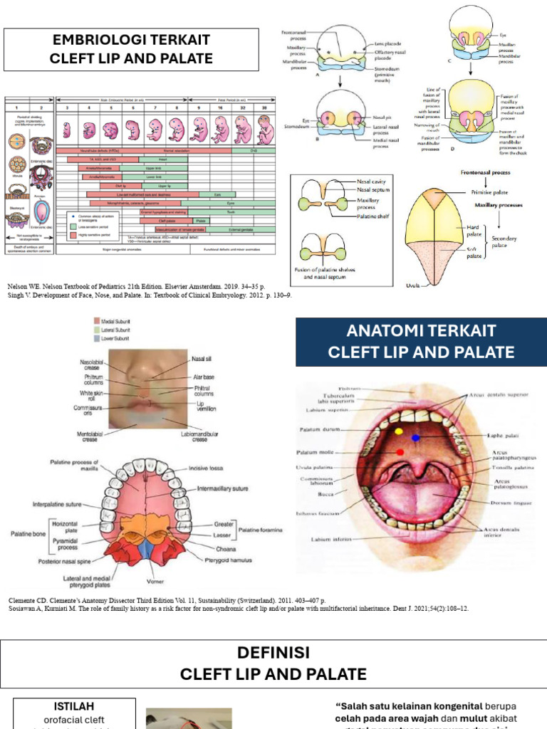 Epidemiologi Sumbing Bibir dan Lelangit | PDF
