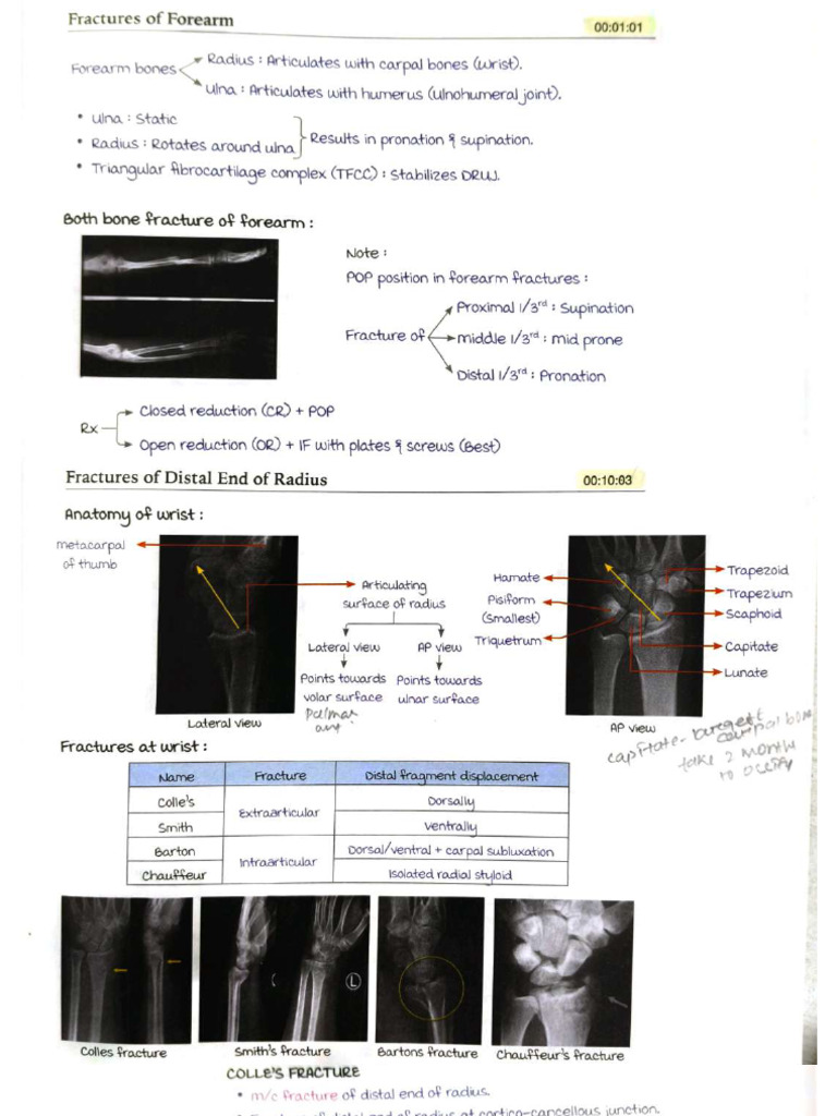 Ortho @marrow Ed8 Notes 2024 Export (1) Cropped | PDF