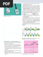 NST vs CTG: Key Differences Explained | PDF