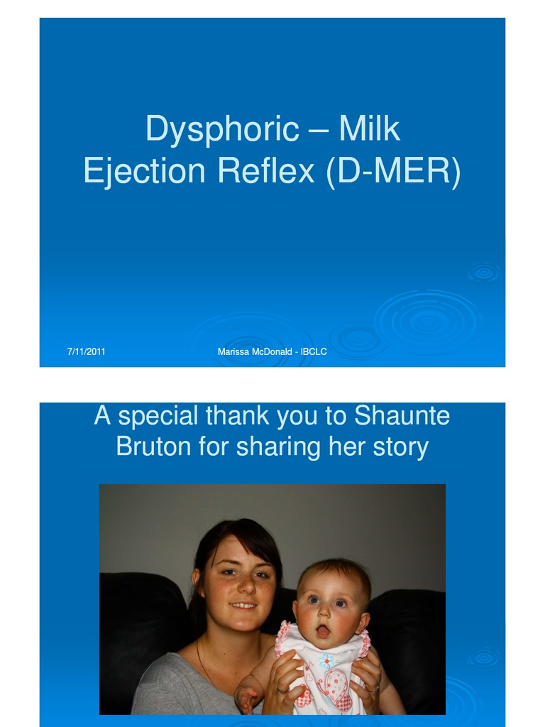 McDonald Marissa - Dysphoric Milk Ejection Reflex | PDF | Lactation | Breastfeeding