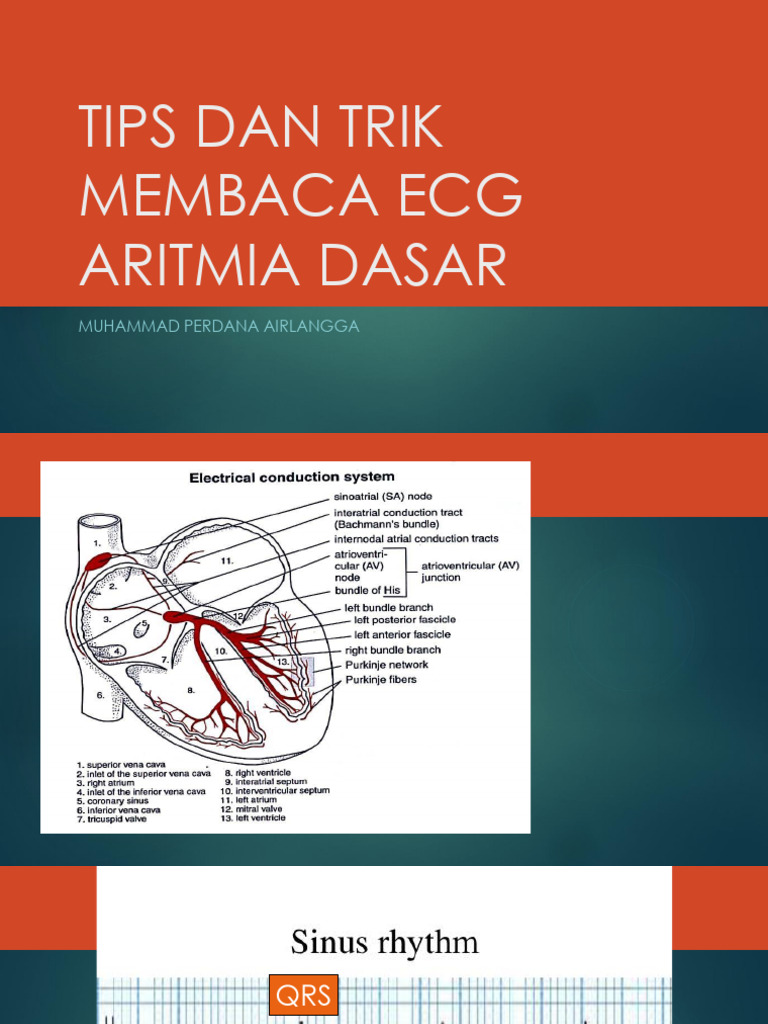 Panduan Membaca ECG Aritmia Dasar | PDF