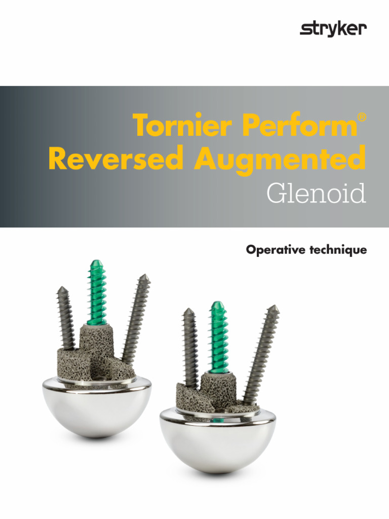 Tornier Perform Reversed Augmented Glenoid Operative Technique | PDF | Shoulder | Screw