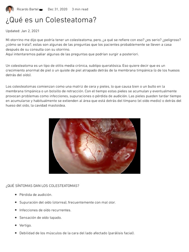 ¿Qué Es Un Colesteatoma? | PDF | Oído | Otorrinolaringología