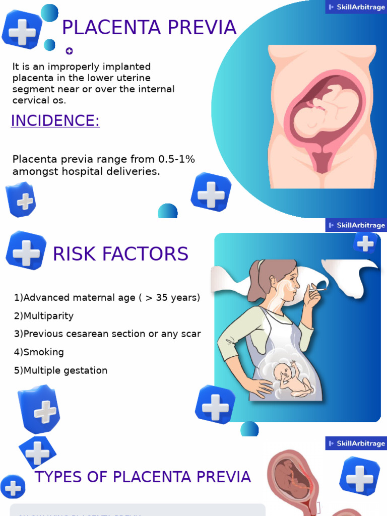 Placenta Previa | PDF