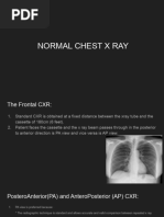 PA vs AP Chest Radiographs Explained | PDF | Radiography | Radiology