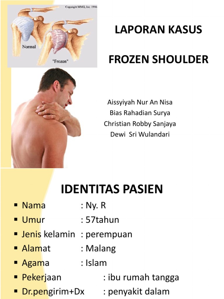 Frozen Shoulder Syndrome | PDF