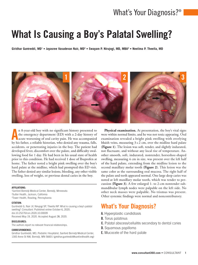 2010C360 WYD Palatal-Abscess | PDF | Diseases And Disorders | Medical ...