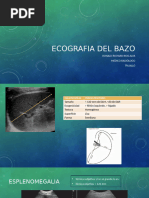 Tamaño y Ecografía del Bazo Normal | PDF | Bazo | Abdomen
