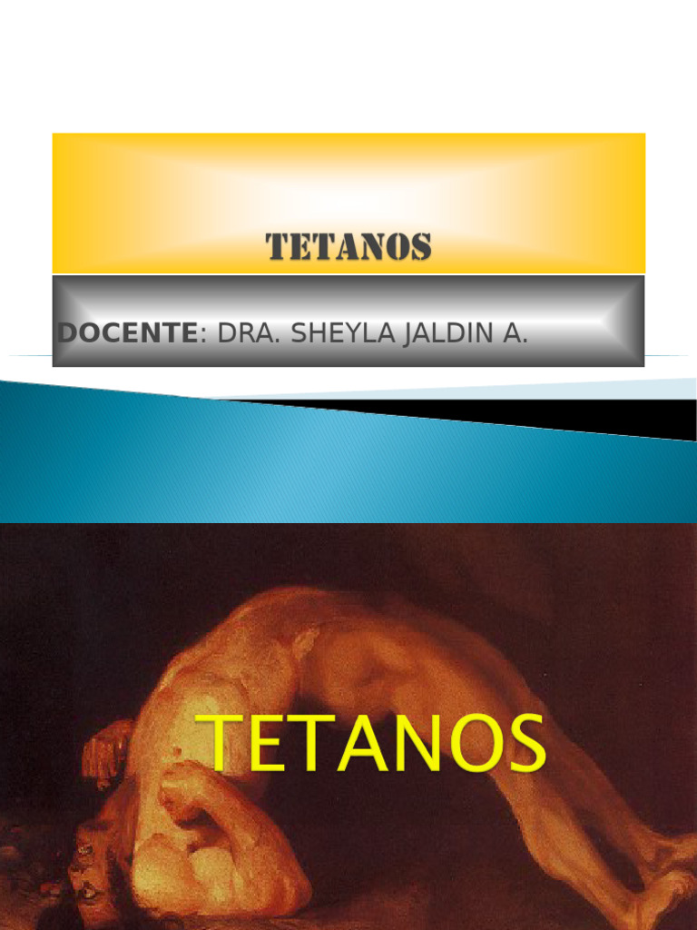 Tétanos Neonatal: Epidemiología y Manejo | PDF | Enfermedades y ...