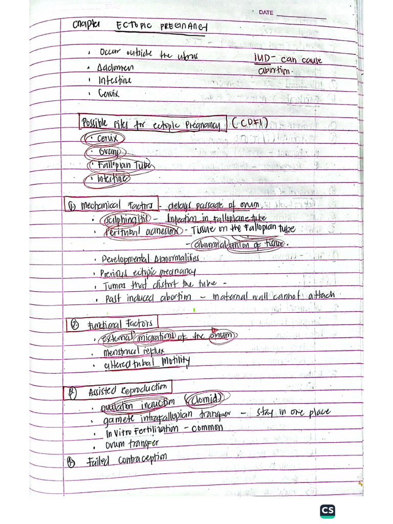 Ectopic Pregnancy Notes | PDF