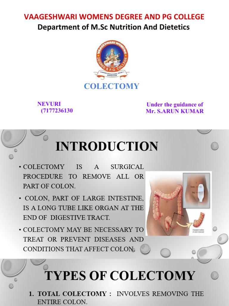 Ysd Presentation - Extracted - 07241558 - Extracted - 07241558 | PDF ...