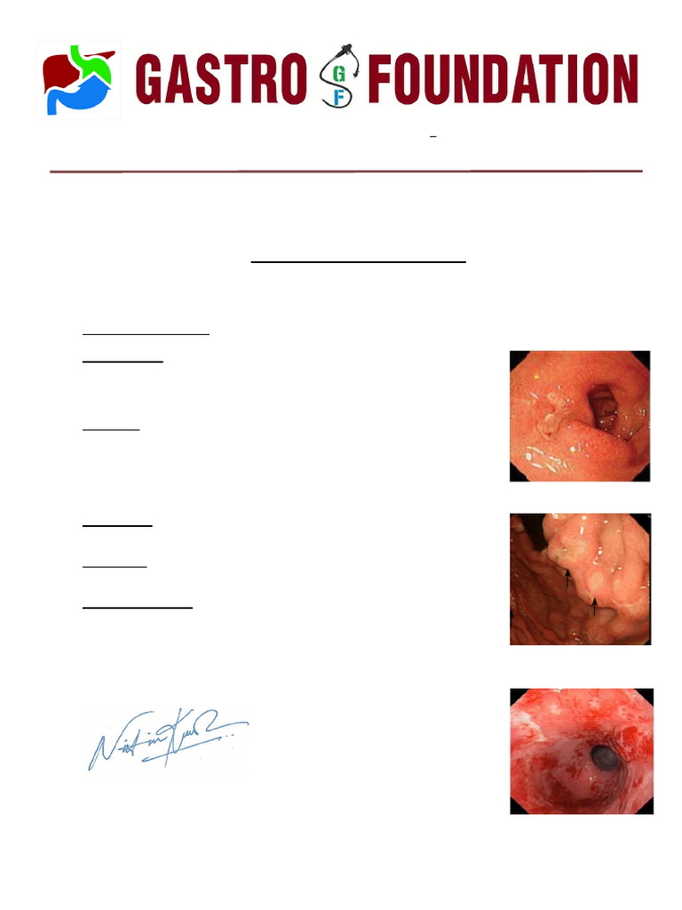Endoscopy Report: Gastritis Findings | PDF