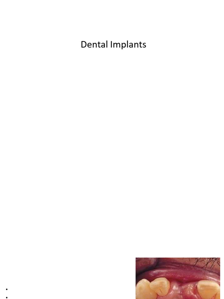 Dental Implant Treatment Planning Guide | PDF | Dental Implant ...