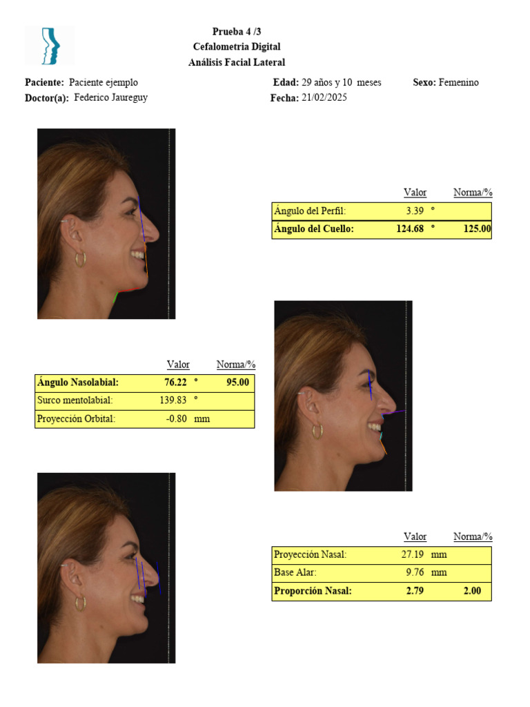 Análisis Facial Lateral en Cefalometría | PDF