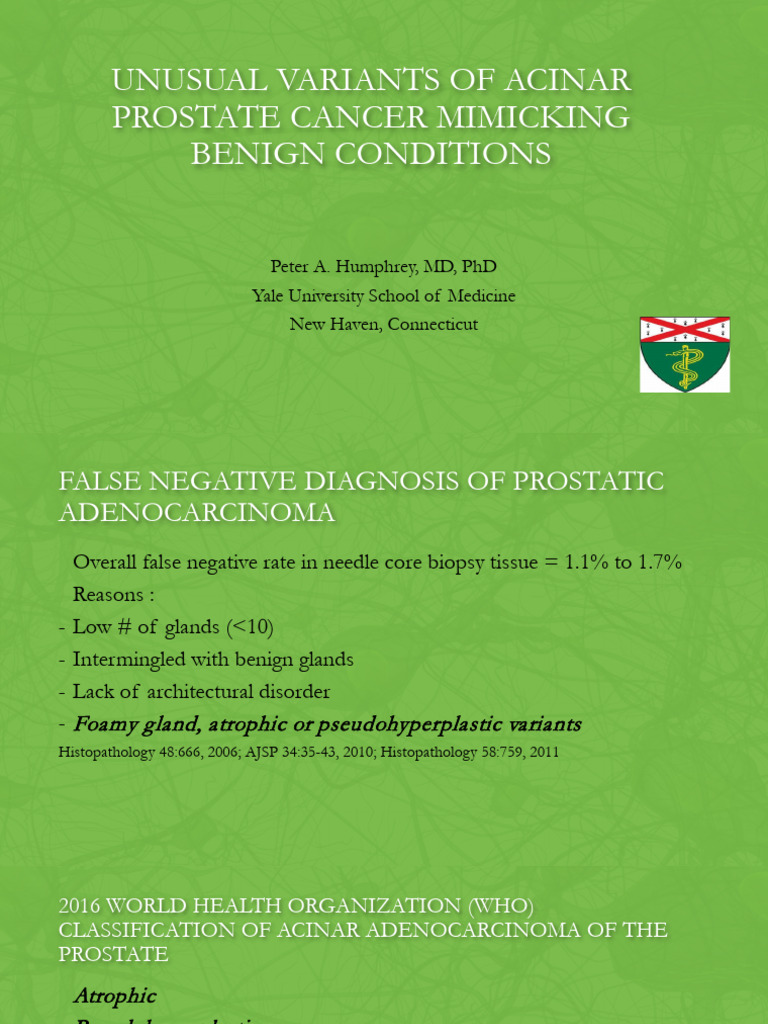 Unusual Variants of Acinar Prostate Cancer Mimicking Benign Conditions ...