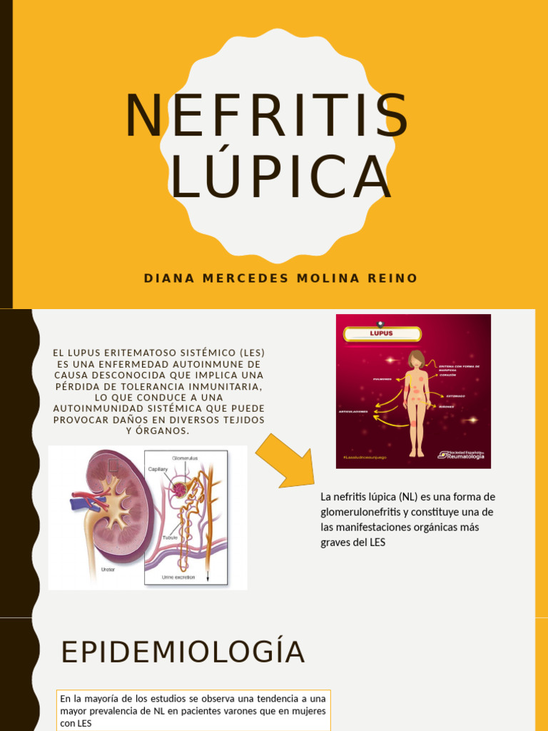 Nefritis Lúpica | PDF | Terapia | Corticosteroides
