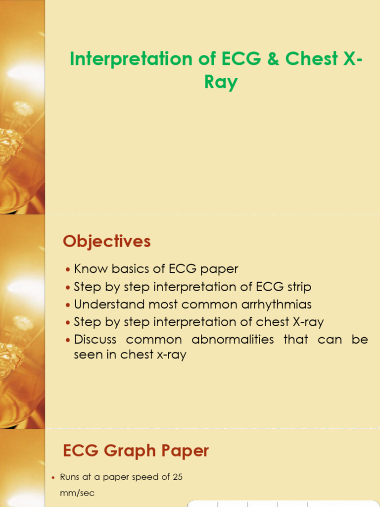ECG & X-Ray Interpretation | PDF | Electrocardiography | Internal Medicine
