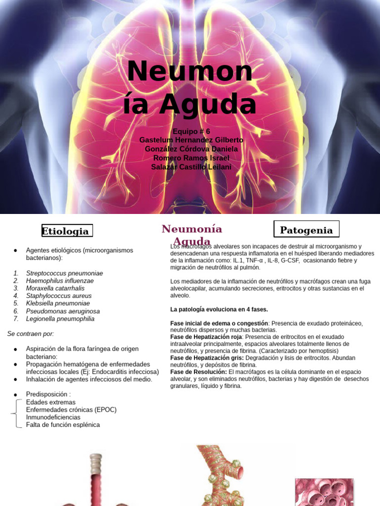 Neumonía Aguda | PDF | Inflamación | Enfermedades y trastornos humanos
