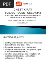 Comprehensive Guide to Chest X-rays | PDF | Lung | Thorax