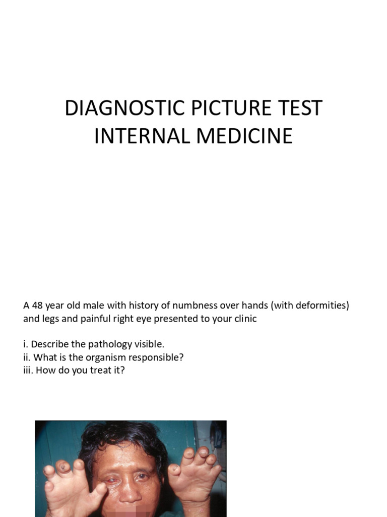 Diagnostic Picture Test in Internal Medicine | PDF | Medical Diagnosis ...