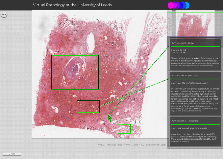 Slide Viewer Virtual Pathology at The University of Leeds 2 | PDF ...