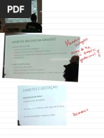 HINTS para Diagnóstico de Vertigem | PDF | Vertigem | Sistema vestibular