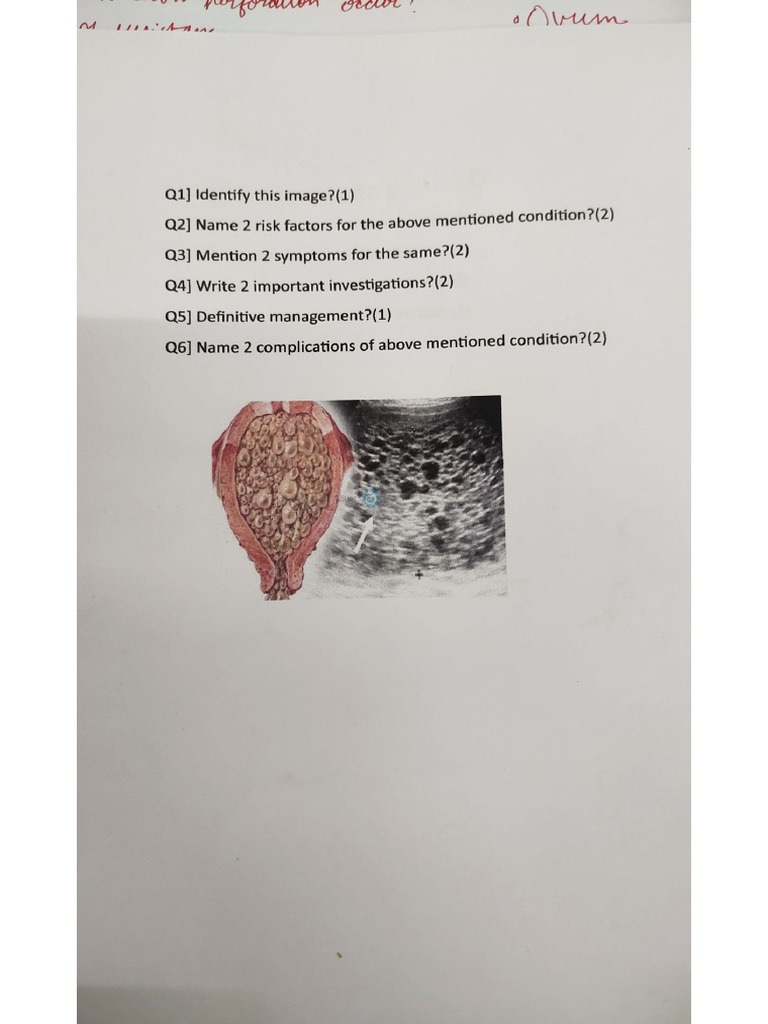 Obg Ospe (Final) | PDF