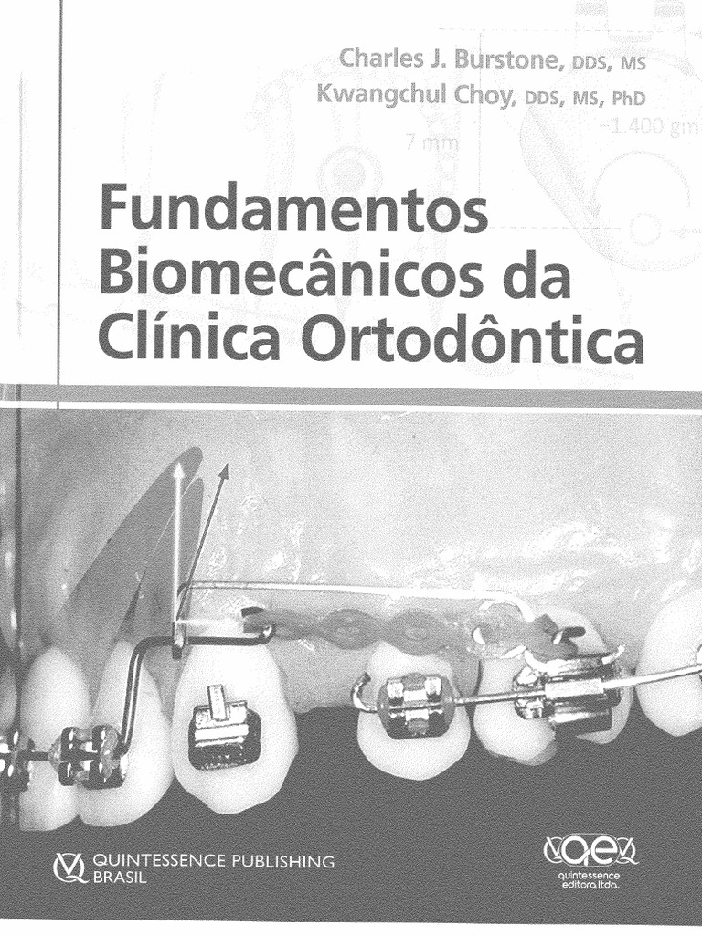 Burstone Parte 1 | PDF