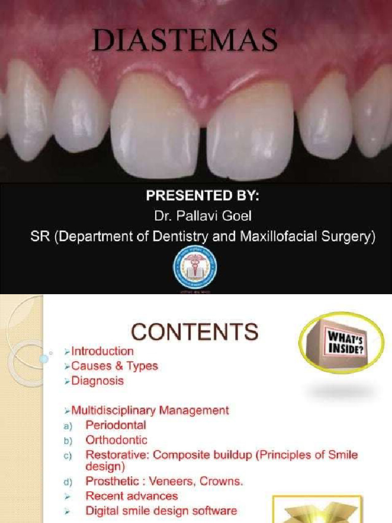 Diastema S | PDF