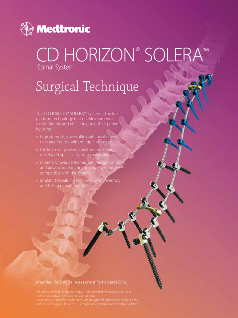 CD HORIZON® SOLERA™ Surgical Technique | PDF | Skeletal System