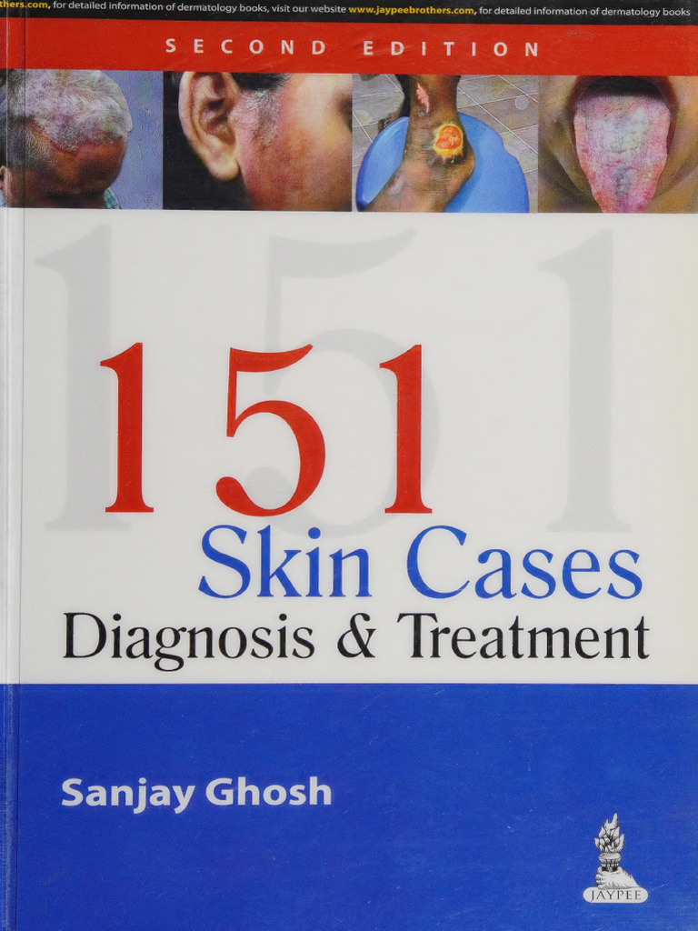 151 Skin Cases: Diagnosis & Treatment | PDF | Psoriasis | Dermatitis