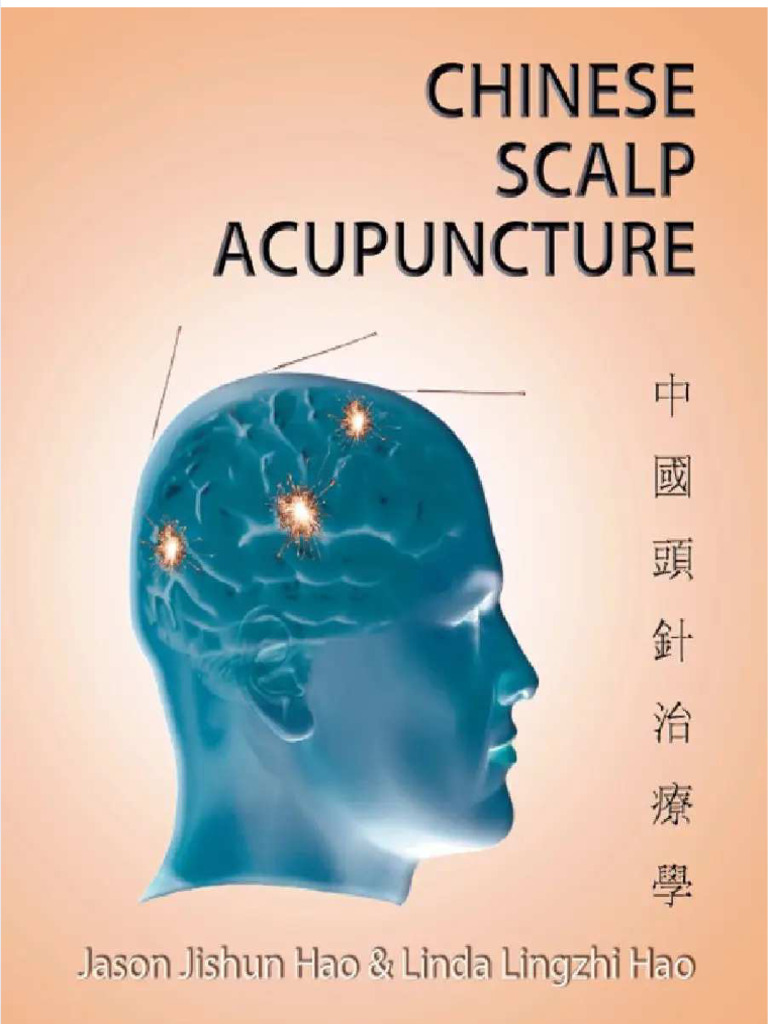 Chinese Scalp Acupuncture | PDF | Acupuncture | Traditional Chinese ...
