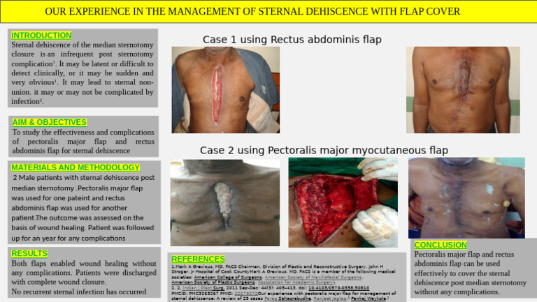 Poster On Management of Sternal Wound Dehiscence | PDF | Medical ...