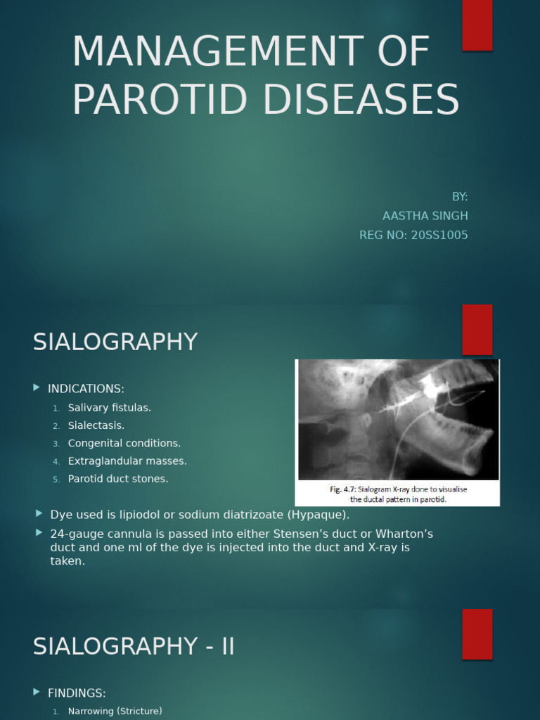 Management of Parotid Diseases | PDF | Clinical Medicine | Medical ...