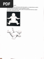 Short Opponens Splint Fabrication Guide | PDF | Hand | Thumb