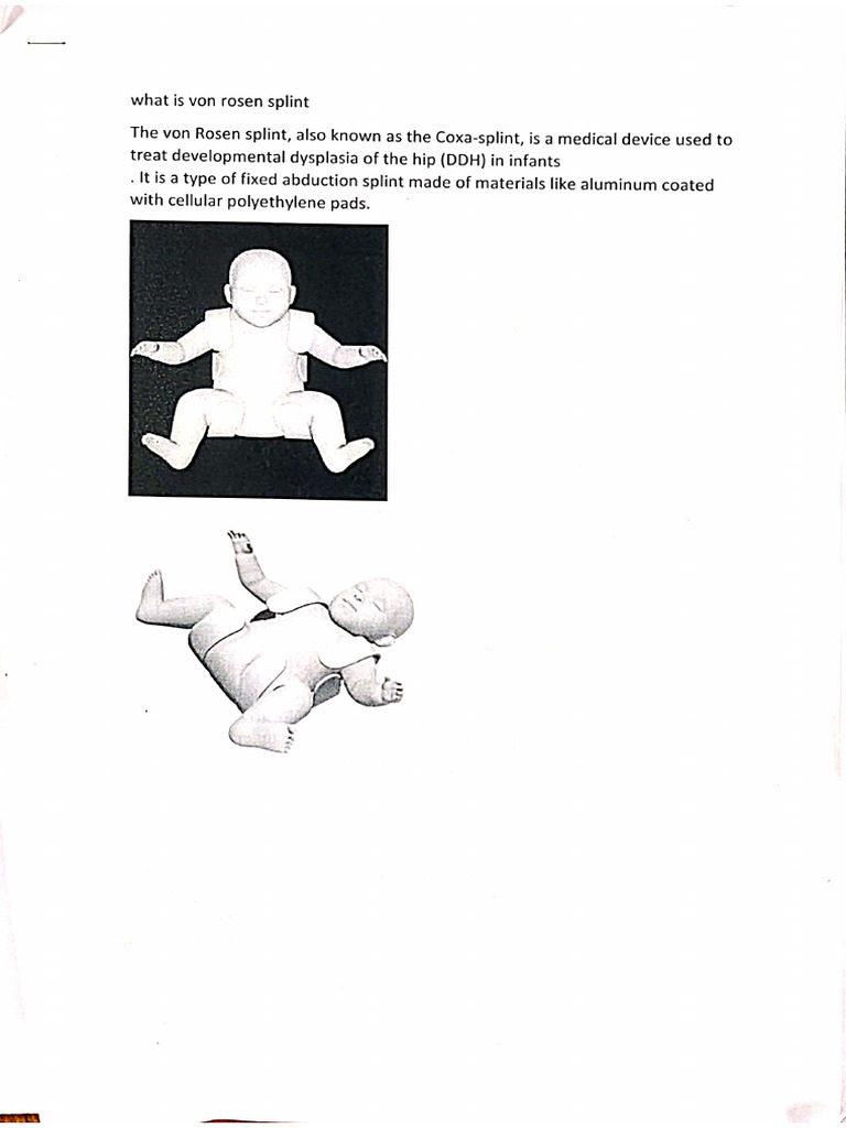 Von rosen splint | PDF