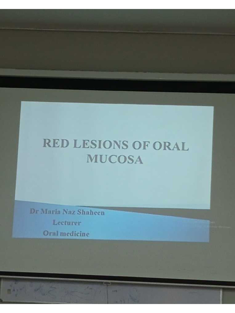 Red Lesion OM | PDF