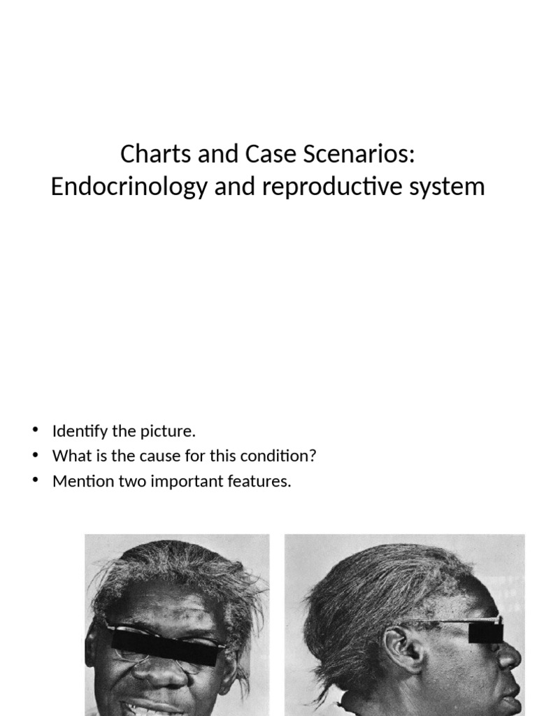 Charts and Case Scenarios Endocrinology | PDF | Glands | Endocrinology