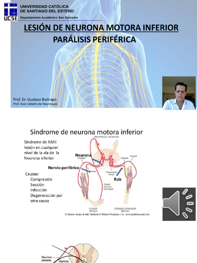 Parálisis Periférica Sgo | PDF | Neurona motora | Sistema ...