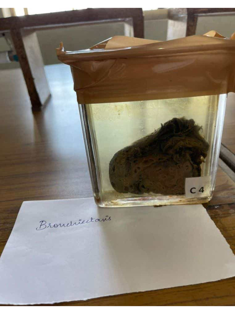 Patho Gross ? ?? | PDF