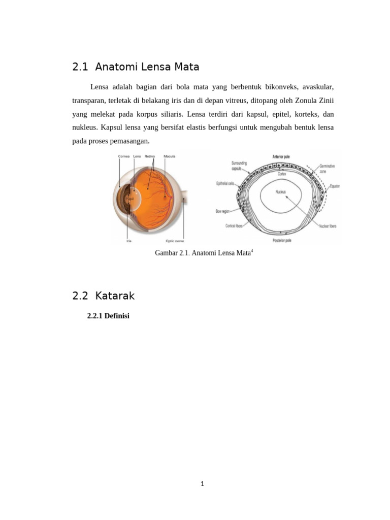 Anatomi dan Penyebab Katarak Mata | PDF
