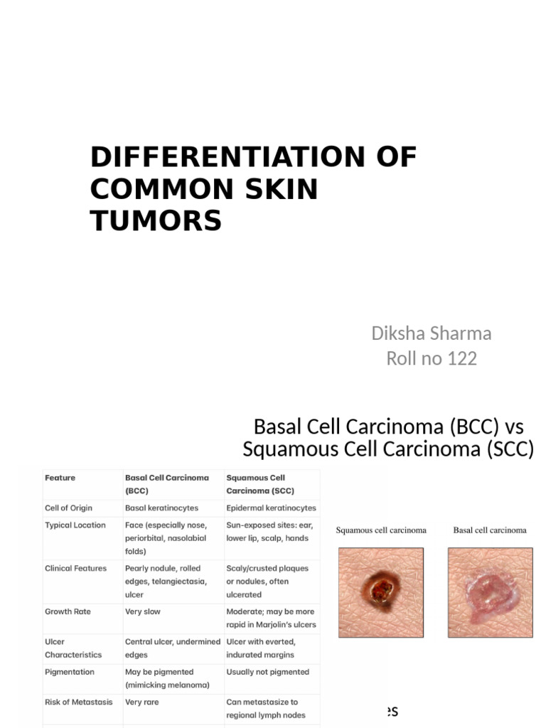Skin Tumour Differentiation | PDF